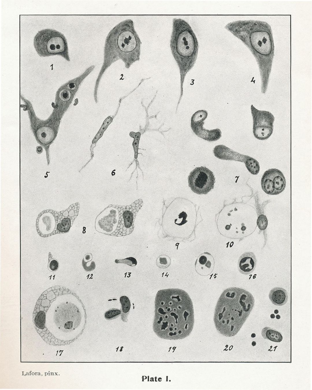 Polio | History of Vaccines