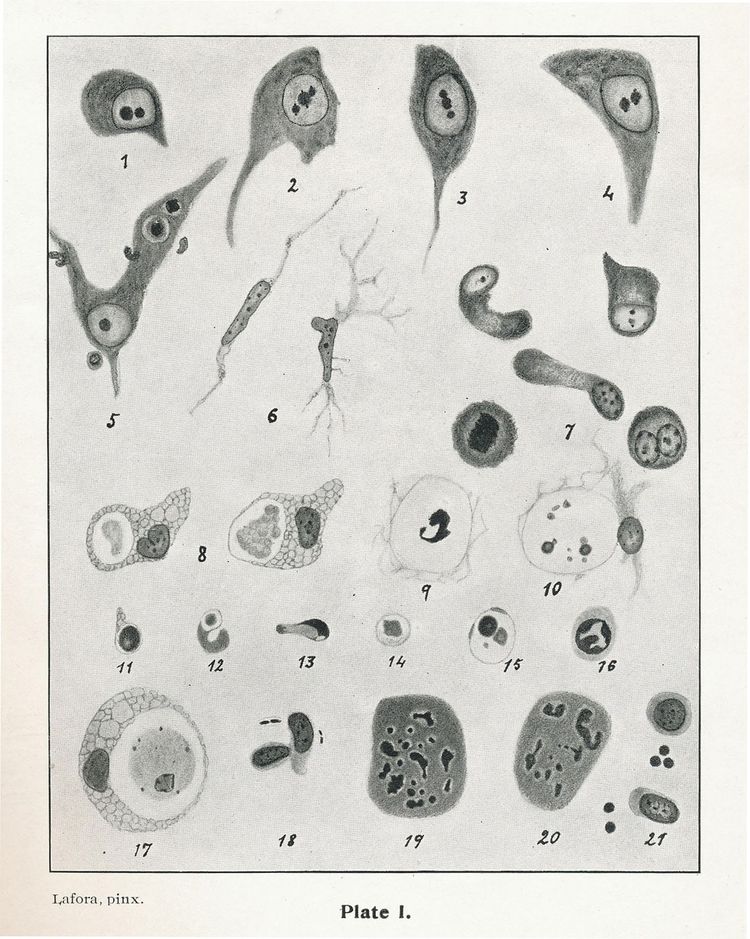 Polio | History of Vaccines