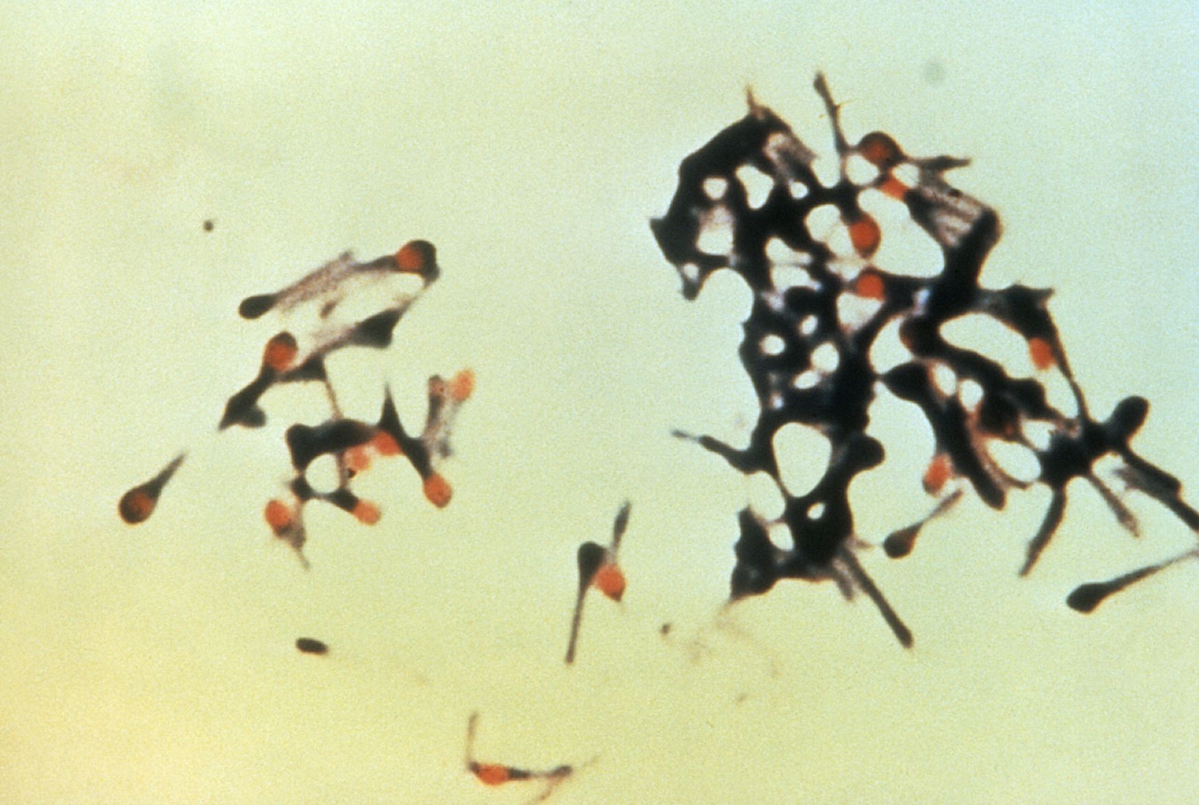 Tetanus | History of Vaccines