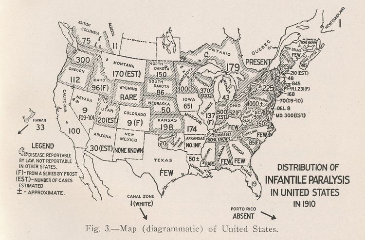 Polio | History of Vaccines