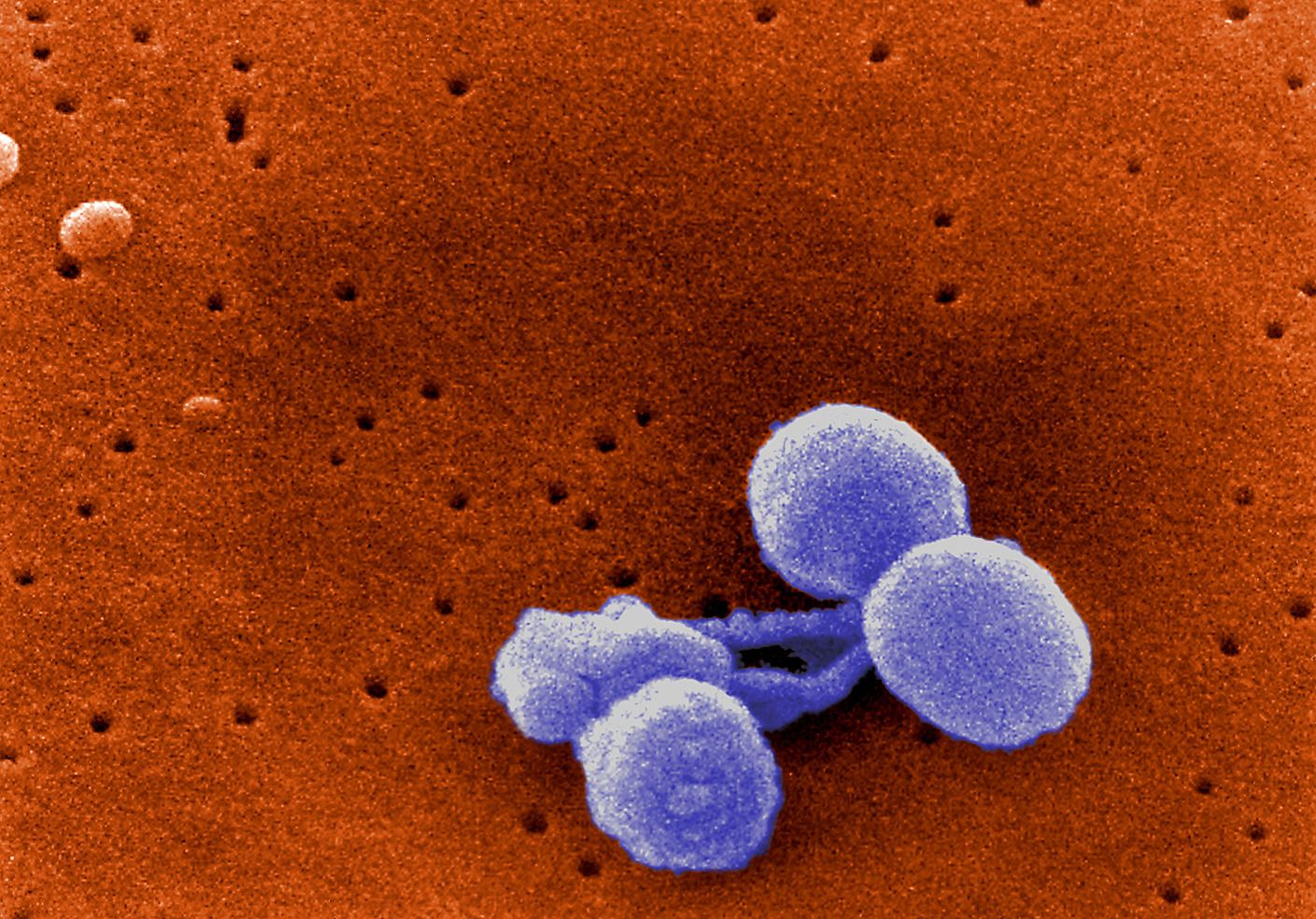 Pneumonia (Pneumococcal Disease) | History of Vaccines