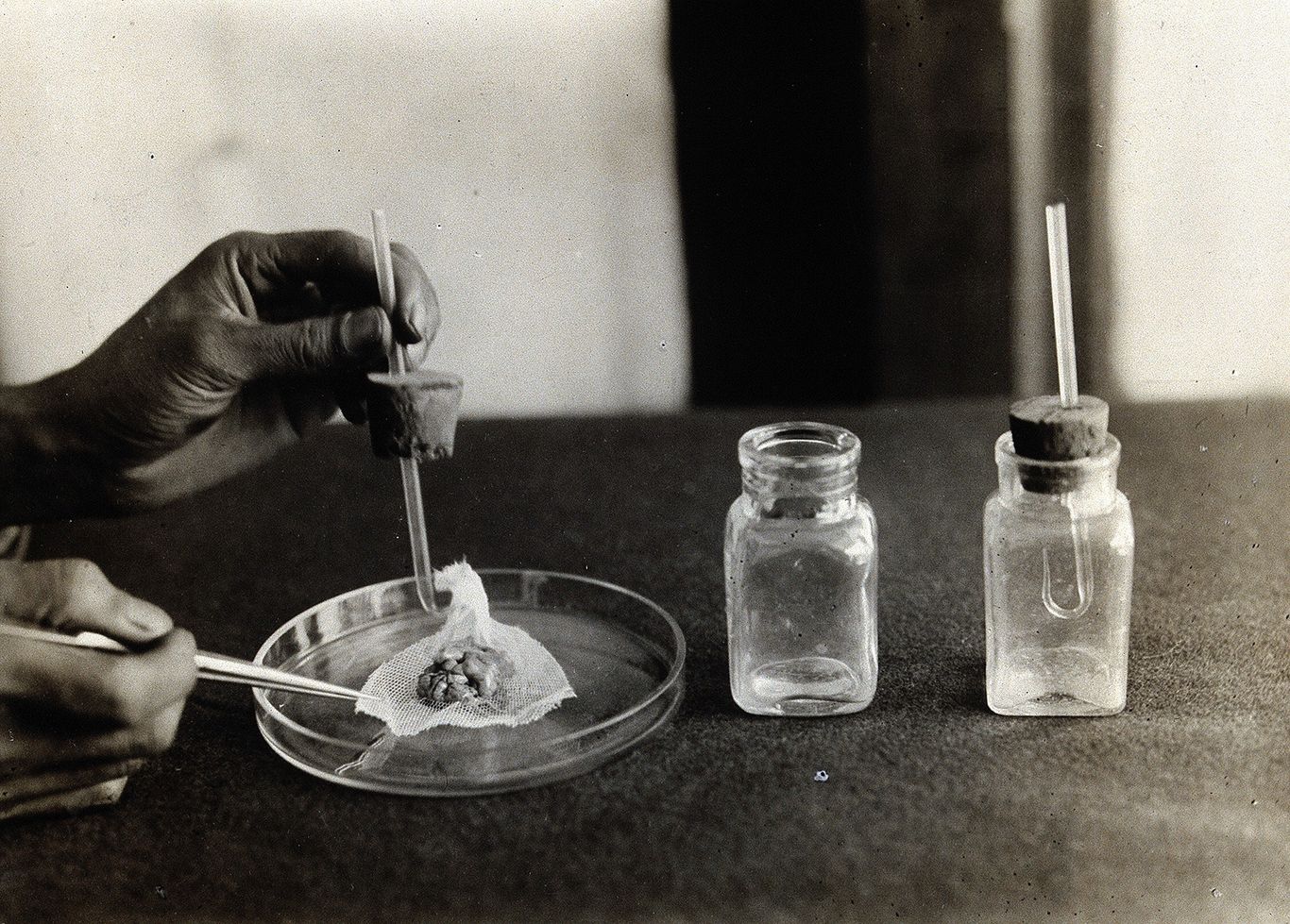 Early Laboratory Methods for Developing Vaccines | History of Vaccines